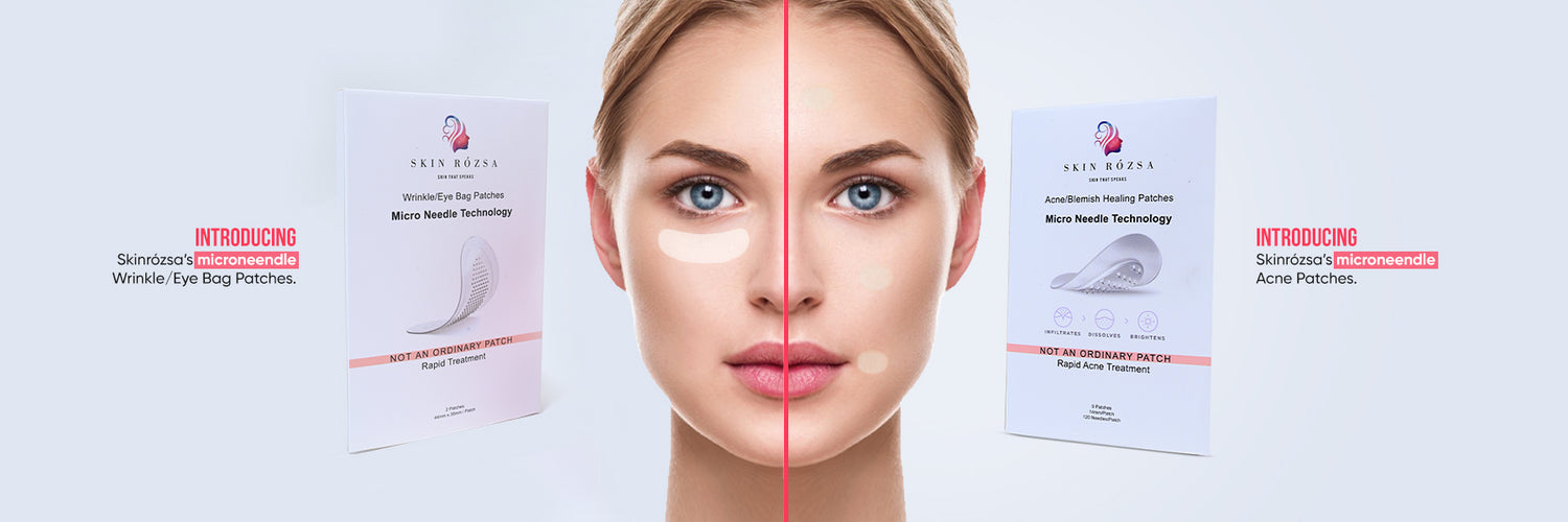 Skin Rózsa | Skin That Speaks